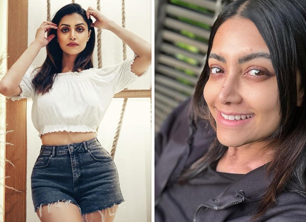 Jana Gana Mana actress Mamta Mohandas opens up about being diagnosed with Vitiligo : Bollywood ...